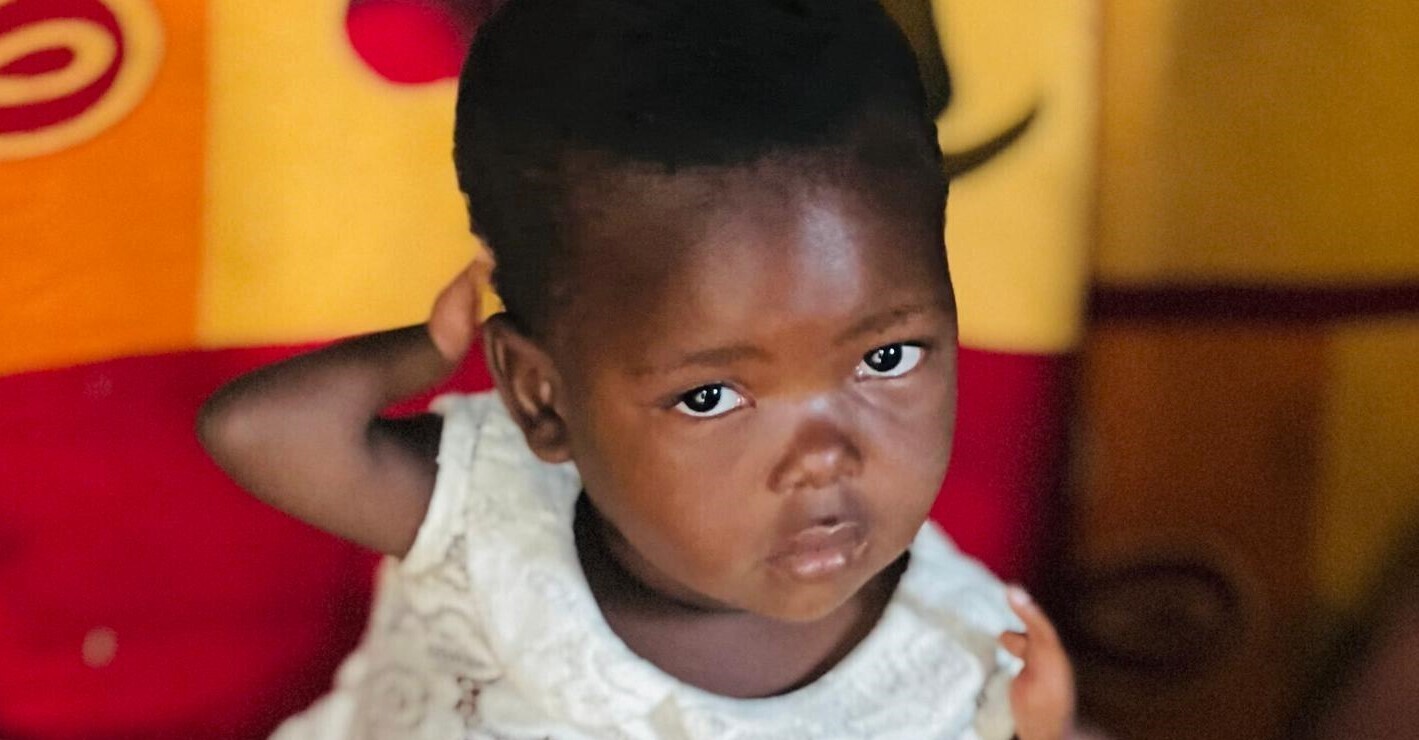 Mercy needs orthopedic surgery. She is unable to stand and walk – UBU e ...